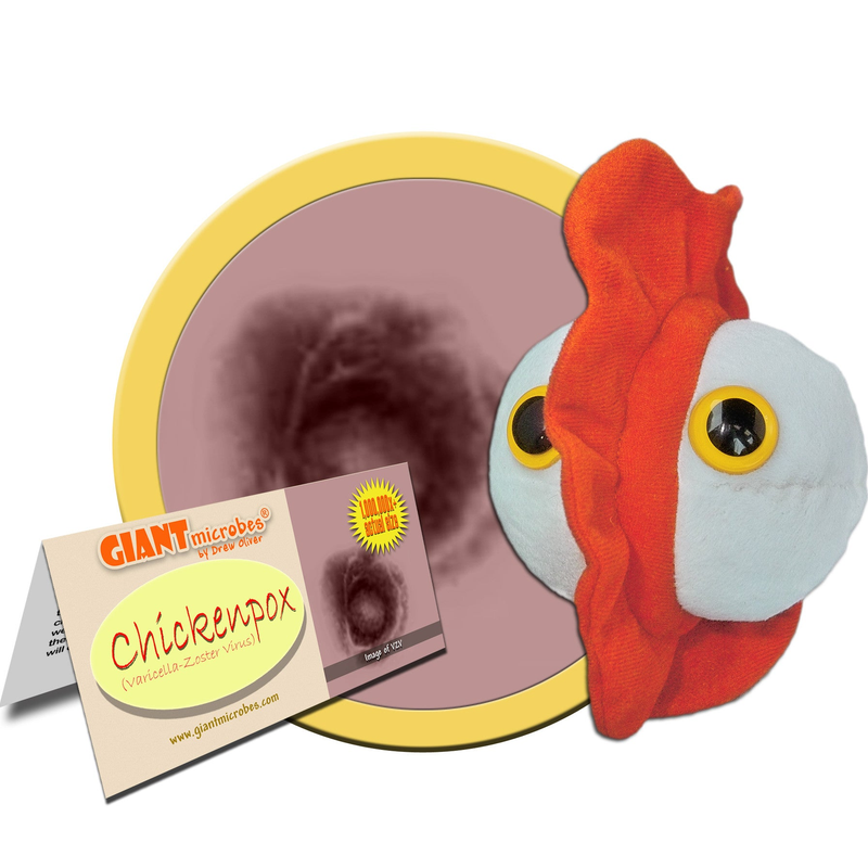 Chickenpox (Varicella-Zoster Virus) - GIANTmicrobes® ... | LabRatGifts ...